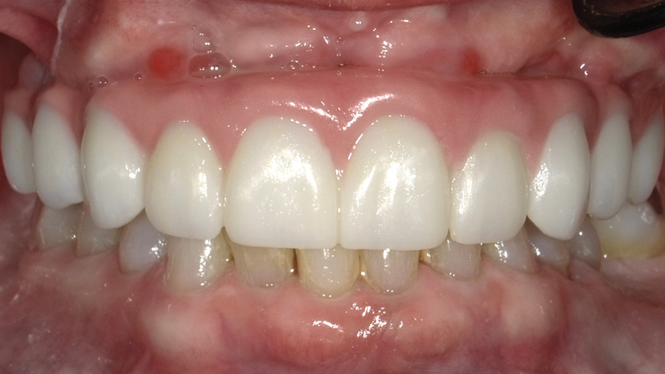 A Powerful Camera for Powerful Dentistry | Inside Dentistry