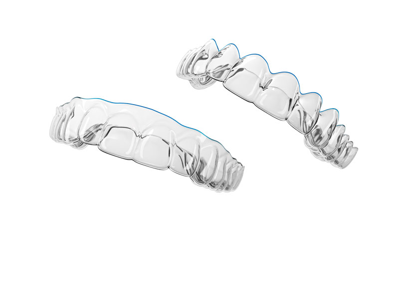 SureSmile® Clear Aligners | Inside Dentistry
